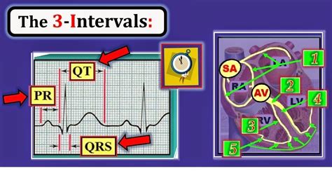 ECG Interpretation ECG Blog Basic Concepts Intervals PR QRS QT