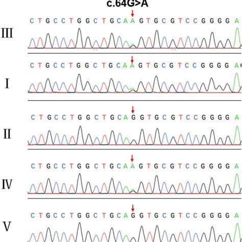fragment of chromatogram showing the sequence of exon 8 of f7 gene in