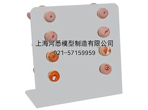 高级子宫宫颈病变模型上海河悉模型制造有限公司