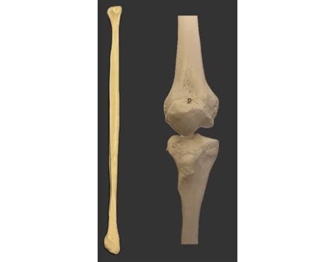 Patella And Fibula Quiz
