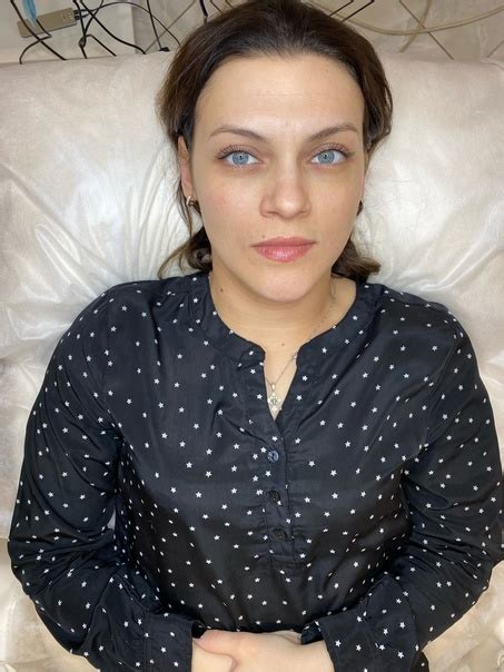 Брови Фото до Фото сразу после процедуры И видео зажившие через