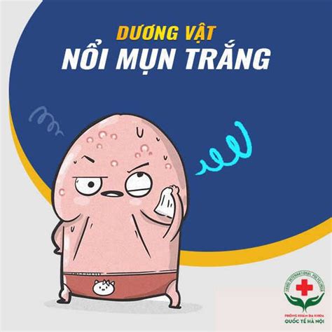 Dương Vật Nổi Mụn Trắng Những Thông Tin Nam Giới Cần Biết