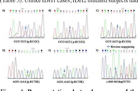 [pdf] Mutation Analysis Of Idh1 2 Genes In Unselected De Novo Acute Myeloid Leukaemia Patients