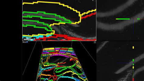 Large Scale Brain Mapping Sc23