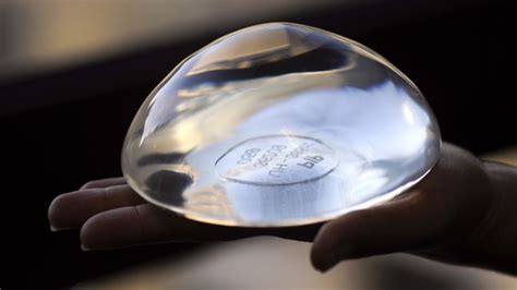 French Court Orders Damages For Victims Of Breast Implant Scandal Cnn