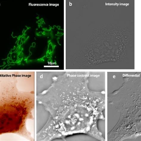 Living Cell Mouse Embryonic Fibroblast Observed With A Fluorescence
