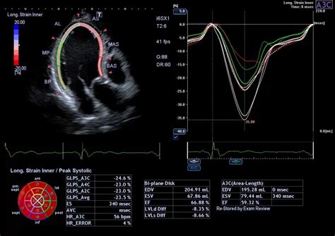 Cardiac Aplio I Series Prism Edition Clinical Gallery Ultrasound