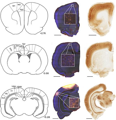 Parietal Cortex Receives Inputs From Regions Along The Full Rostral To