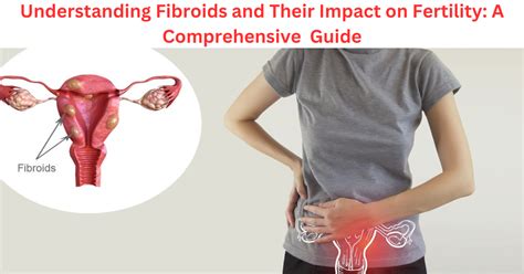 Understanding Fibroids And Their Impact On Fertility A Comprehensive Guide By Anushree Rawat