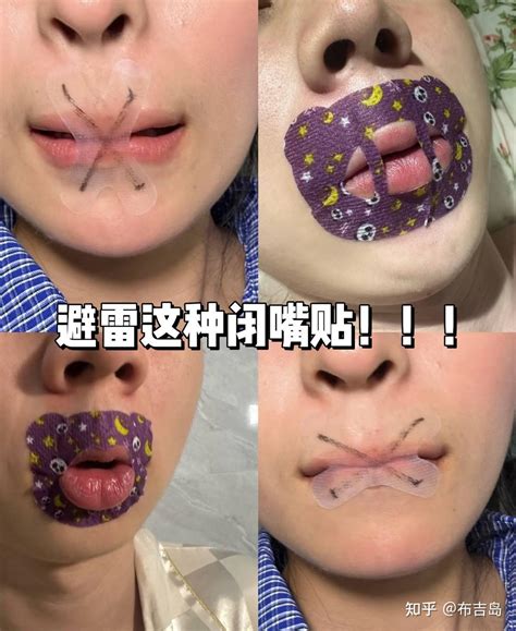 打鼾等于睡得香？小心是睡眠呼吸暂停在作祟！深度科普睡眠呼吸暂停（osa），一文讲透哪种止鼾措施最靠谱，可孚呼吸机为何成靠谱止鼾利器！ 知乎