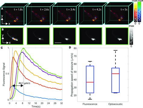 Dual Modality Volumetric Optoacoustic Tomography Oat And Fluorescence
