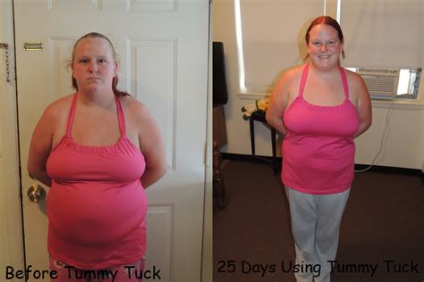 Ambers Unique Coupon Page Tummy Tuck Miracle Slimming System Review