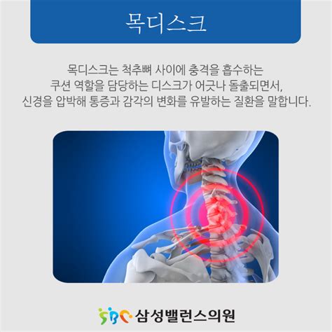 삼성역통증의학과 목디스크 초기증상 치료 이렇게 네이버 블로그