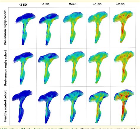 Figure 7 From Integration Of Diffusion Tensor Imaging Parameters With Mesh Morphing For In Depth