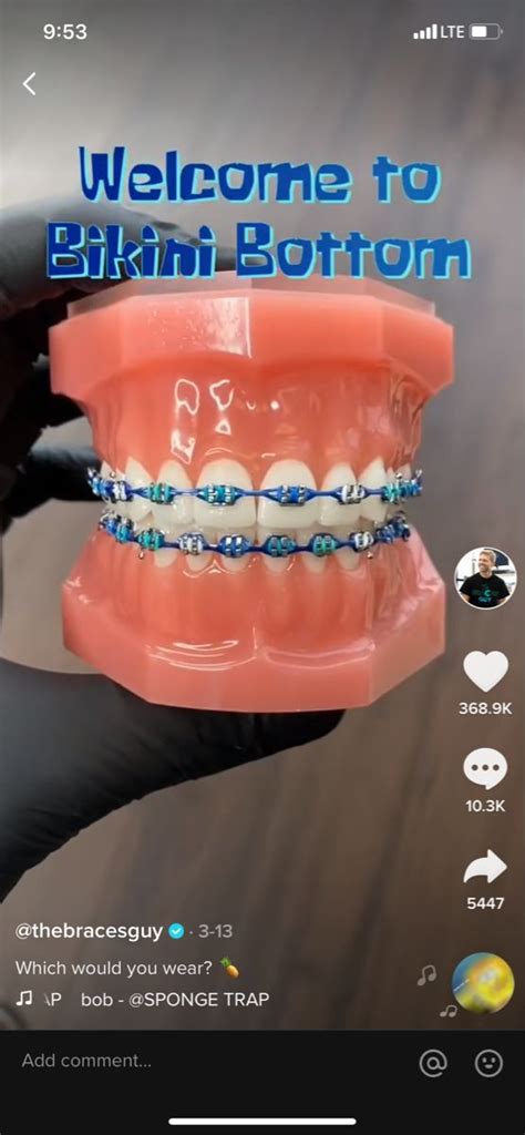 Pin By Dollyann Fisher On Braces Tips Braces Colors Dental Braces Colors Getting Braces