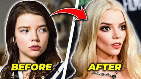 Anya Taylor Joys Height Weight Measurements And Plastic Surgery