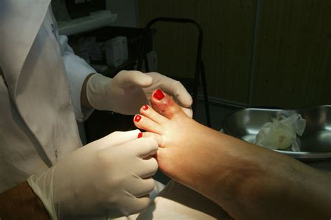 What Your Nails Say About Your Health