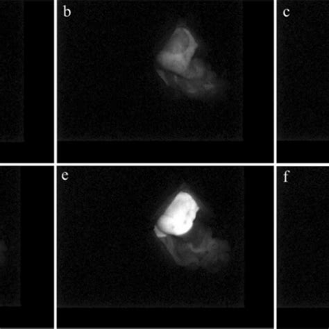 Icg Fluorescence Imaging Process A 5 S After Icg Injection B 15 S
