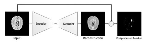 Auto Encoder Based Brain Anomaly Segmentation The Segmentation Map Was Download Scientific