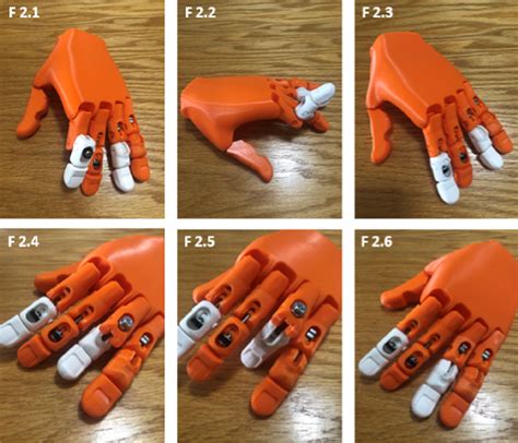 Proximal Interphalangeal Joint PIPJ Complex Dorsal Dislocation With Download Scientific