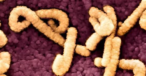 ¿qué Es El Virus De Marburgo La Mortal Enfermedad Que No Tiene