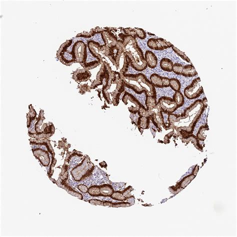 Tissue Expression Of Akr1c2 Staining In Stomach The Human Protein Atlas