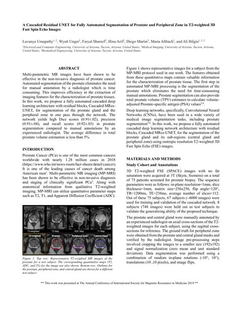 PDF A Cascaded Residual UNET For Fully Automated Segmentation Of