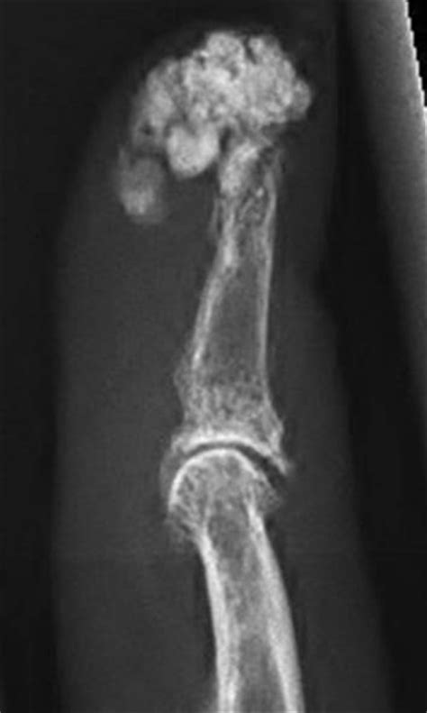 Musculoskeletal Joints And Tendons 6 4 Fingers Case 6 4 10