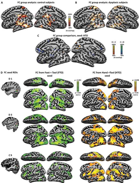 Connectivity From The Occipito Temporal Cortex Reflects Intact Visual Download Scientific