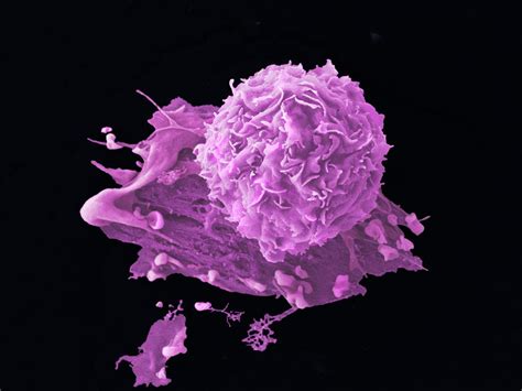 Exploding Cancer Cells Scientists Discover New Way To Combat The