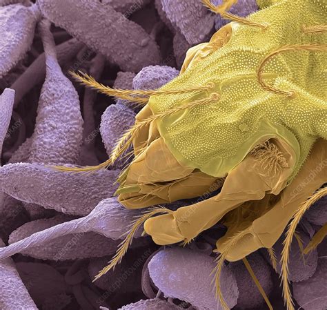 Mite Feeding On Raspberry Rust Sem Stock Image C054 5537 Science