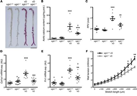 Jci Sgk1 Induces Vascular Smooth Muscle Cell Calcification Through Nf