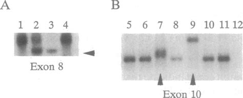 Pcr Sscp Analysis Of Wti Exon 8 In Wit 29 And Wti Exon 10 In Wit 24 And