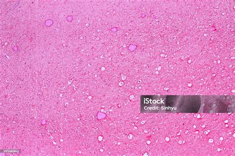소 뇌 및 신경 인간 교육 실험실에 대 한 현미경의 크로스 섹션 가지돌기에 대한 스톡 사진 및 기타 이미지 가지돌기 개념