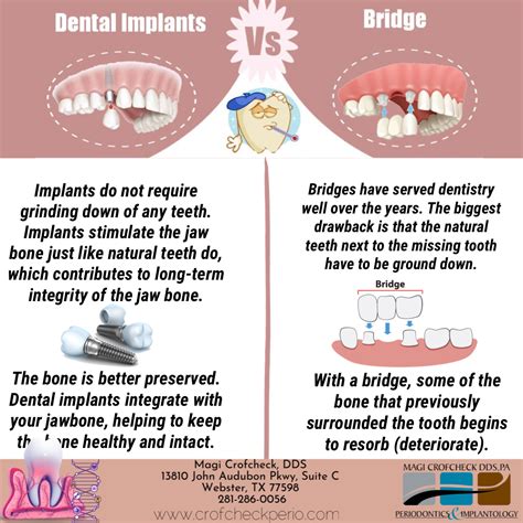 How Can You Pick A Root Canal Dentist Artofit