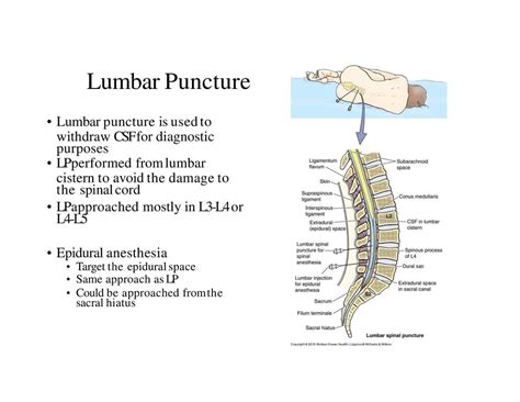 Lumbar Cistern