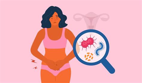 Bacterial Vaginosis Is A Sexually Transmitted Infection Evidence Network