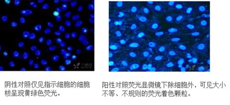 聊聊细胞支原体污染 广西卓一生物技术有限公司