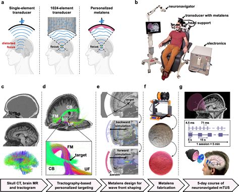 Deep Transcranial Ultrasound Stimulation Using Personalized Acoustic