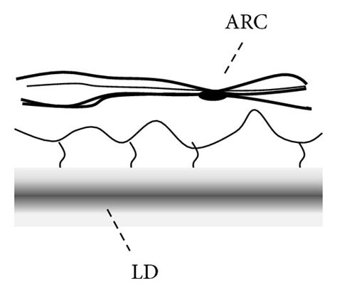 Rearrangement Of Actin Cytoskeletons A Podocyte Foot Processes And Download Scientific