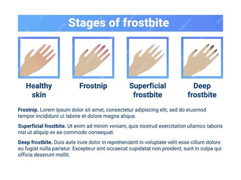 Premium Vector Avoiding Frostbite Banner With Visual Symptoms