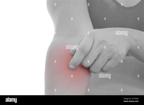 Itching Of Skin Diseases In Women Using The Hand Scratching Red Around