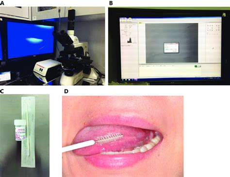 Figure S1 Dna Image Cytometry Icm Device And Cytobrush Kit A The