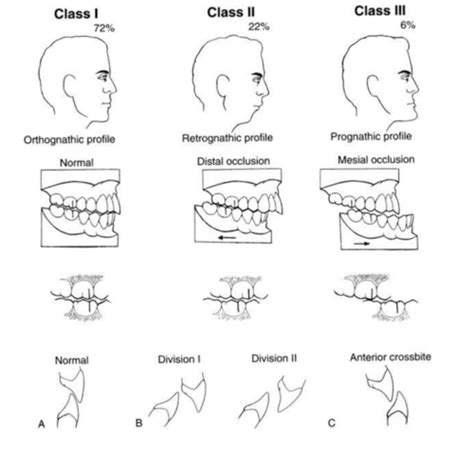 Static Occlusion Flashcards Quizlet