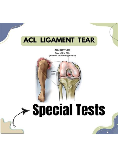 Tests For Acl Ligament Tear Pdf