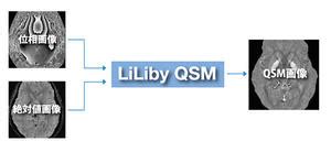 日立製作所 医用画像博覧会 MR画像から磁化率を定量化するQSMを単体ソフトウエアとして製品化
