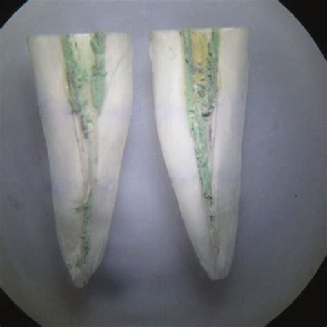 Mtwo Retreatment Mtwo R Sample Download Scientific Diagram