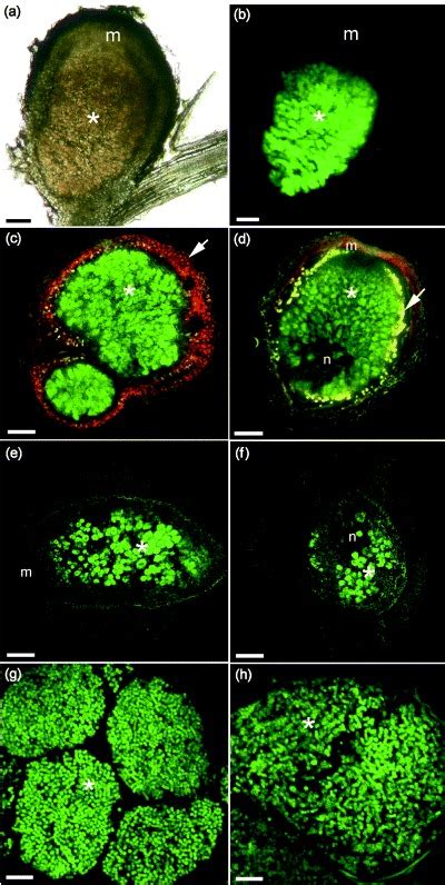 Sections Of Mimosa Nodules Infected With Burkholderia Phymatum Download Scientific Diagram