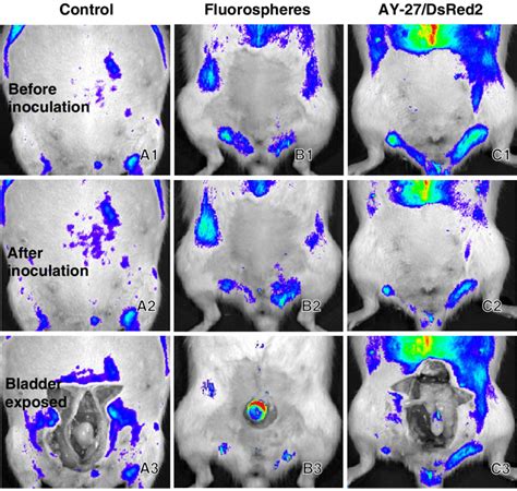 Detection Of Fluorescence Following Externalisation Of The Bladder