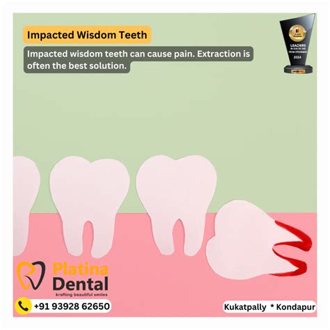Wisdom Tooth Pain Platina Dental Best Dental Clinics In Hyderabad
